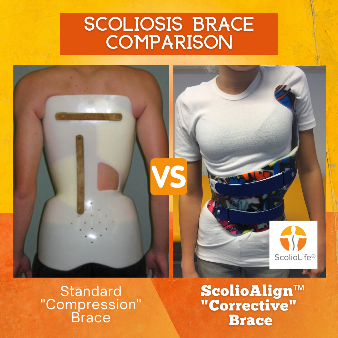 ScolioAlign™ 3D Scoliosis Brace | Non-Surgical Treatment